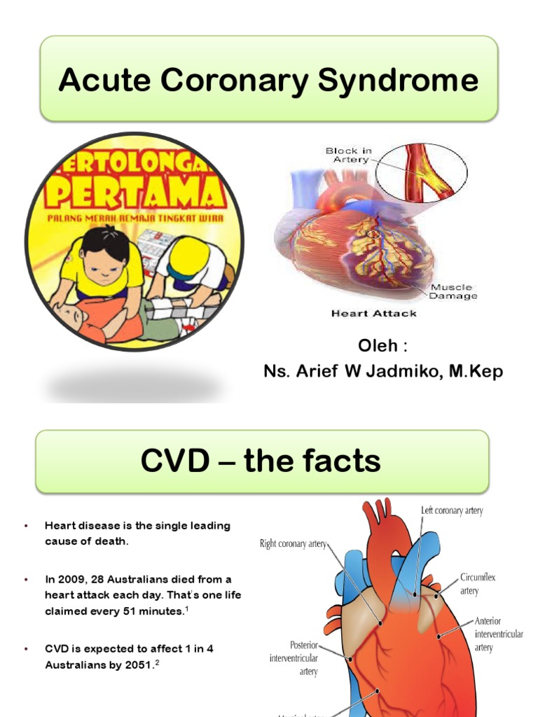Acute Coronary Syndrome | PDF | Myocardial Infarction | Heart