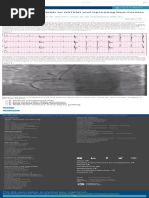 Diastolic Assessment ASE Guidelines | PDF | Diastole | Echocardiography