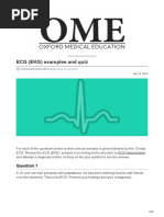 ECG EKG Examples and Quiz | PDF | Electrocardiography | Cardiac ...
