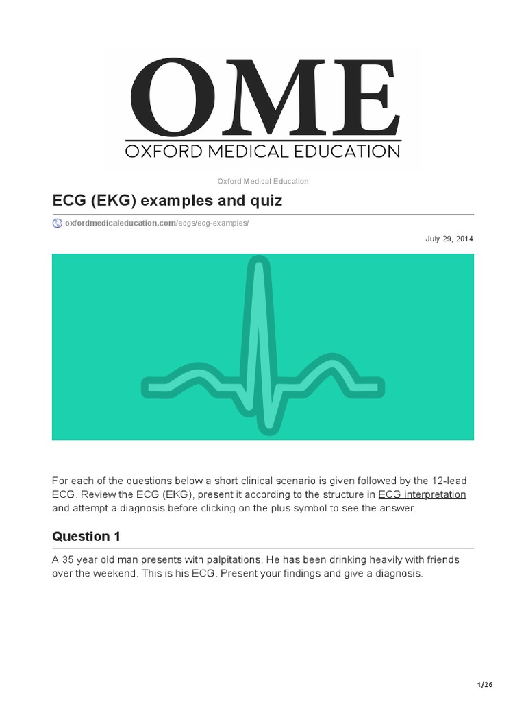 ECG (EKG) Examples and Quiz: Oxford Medical Education | Download Free ...
