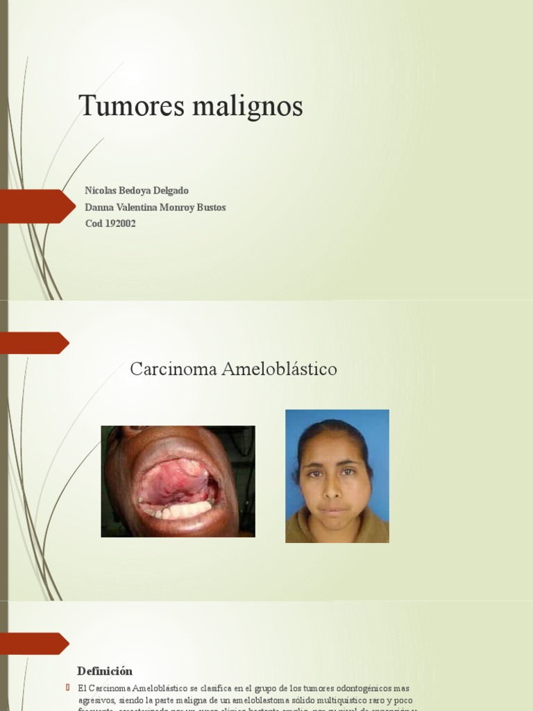 Tumores Malignos | PDF | Neoplasias | Anatomía