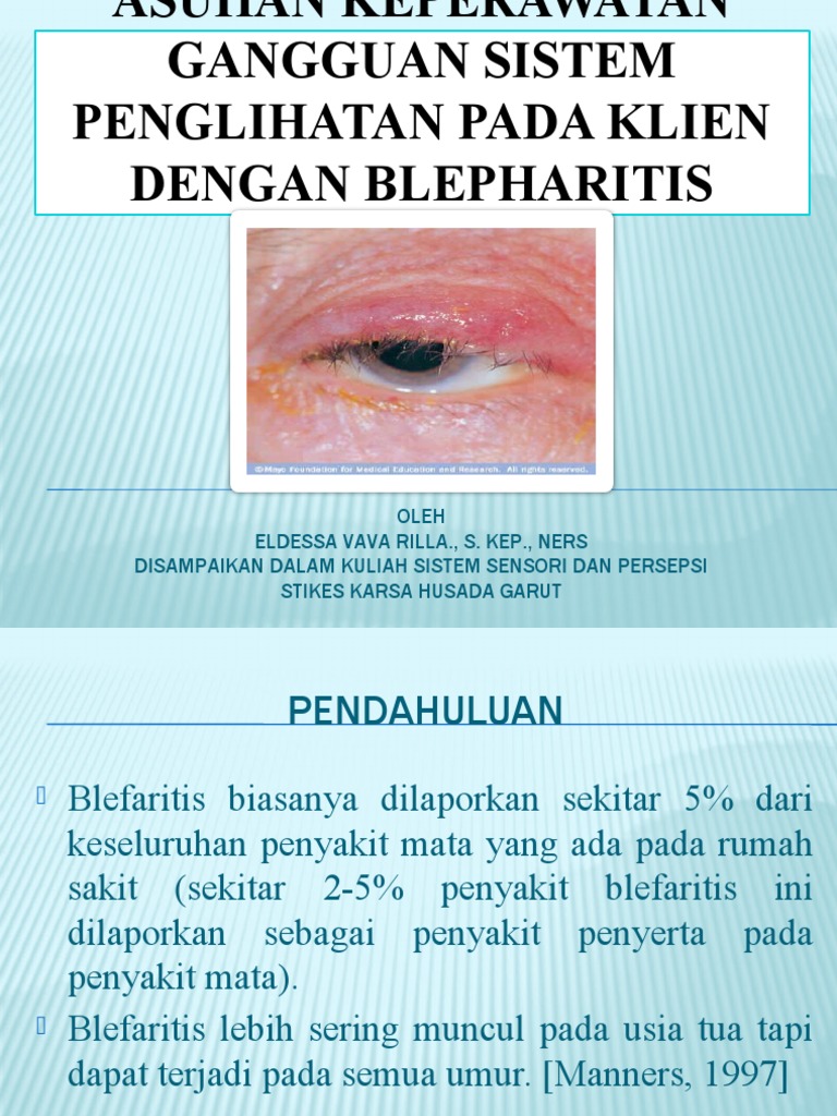 Askep Blepharitis | PDF
