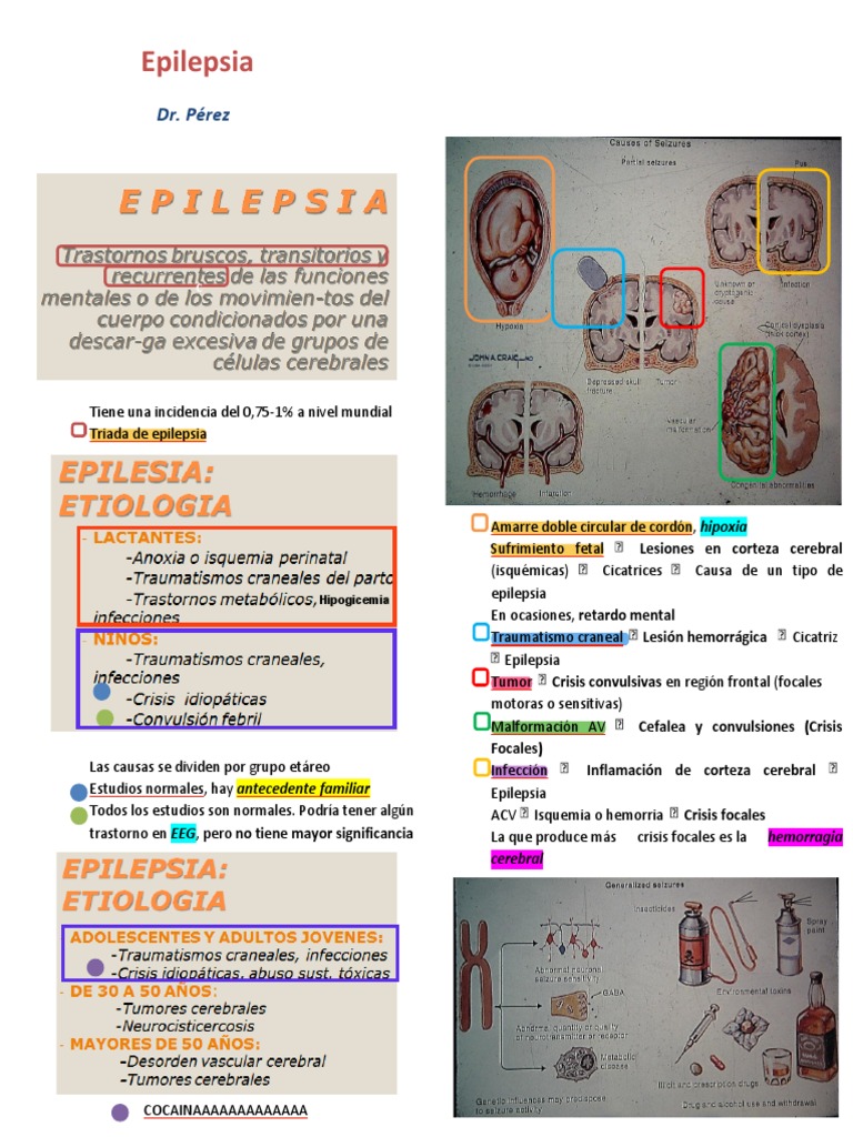 Epilepsias | PDF | Epilepsia | Enfermedades y trastornos humanos
