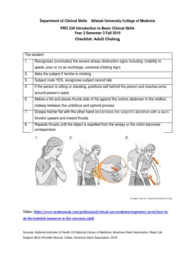 Adult Choking: Heimlich Maneuver Steps | PDF