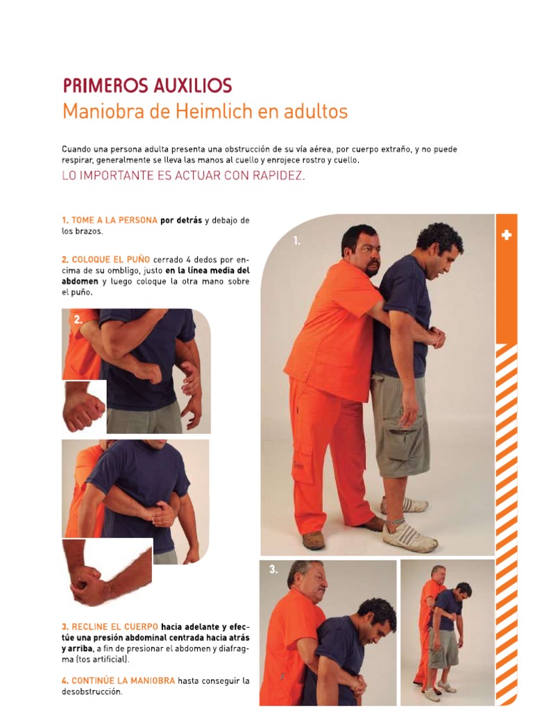 Heimlich | PDF
