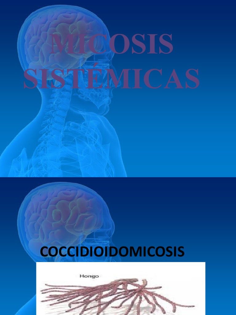 Micosis Profunda | PDF | Tos | Medicina CLINICA