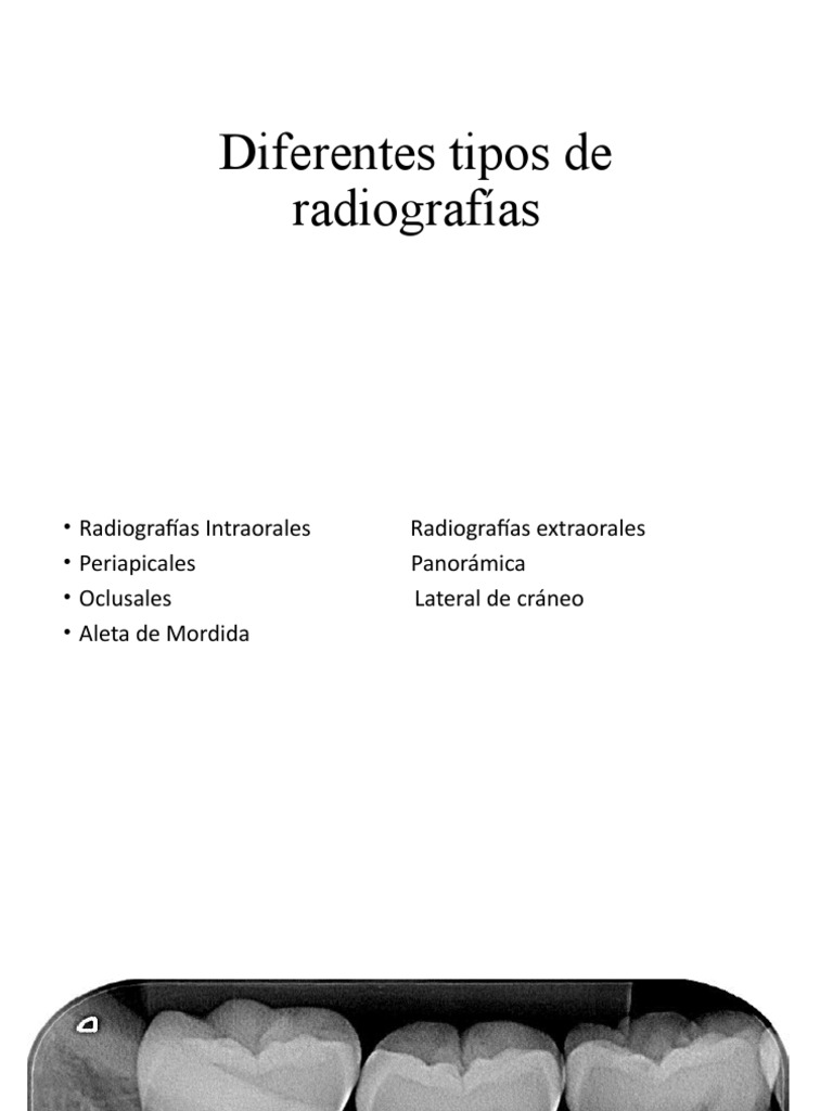 Tipos de Radiografías Dentales | PDF | Viajes y turismo | Ciencia y ...