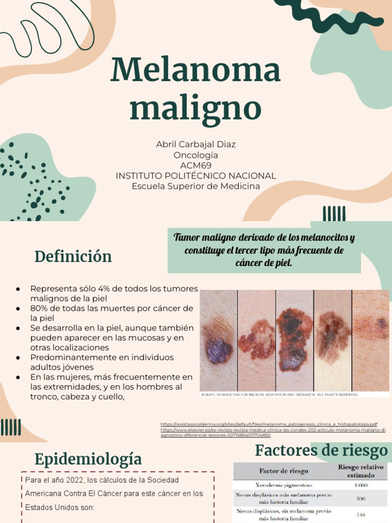 Melanoma Maligno | PDF | Melanoma | Cáncer