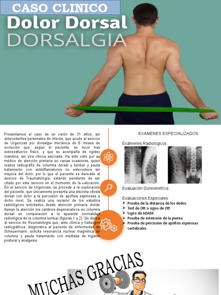 Caso clínico: Dorsalgia y enfermedad de Scheuermann | PDF