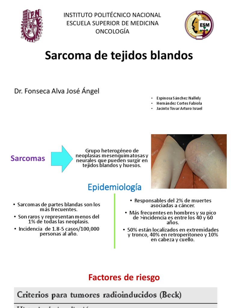 Síntomas y tratamiento del sarcoma | PDF | Sarcoma | Cáncer