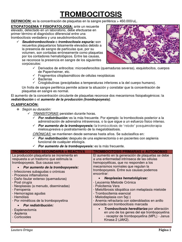Trombocitosis: Definición y Clasificación | PDF | Plaqueta | Hemostasia
