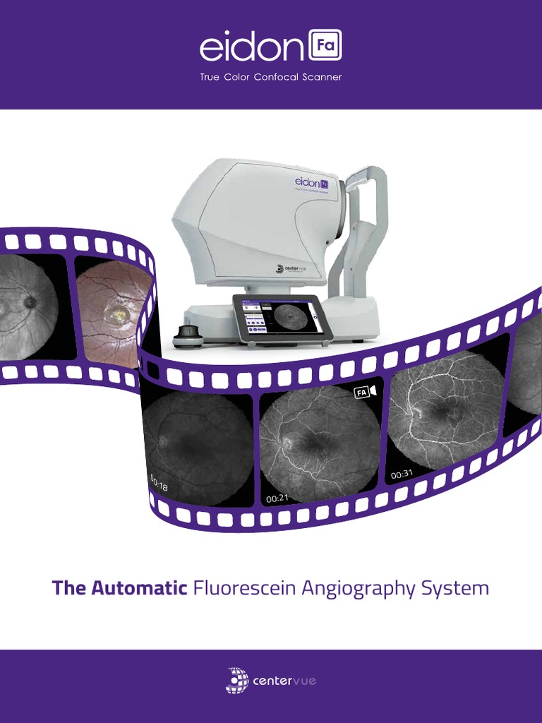 The Automatic Fluorescein Angiography System | PDF | Retina | Infrared