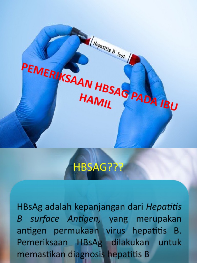 Pemeriksaan Hbsag Pada Ibu Hamil | PDF