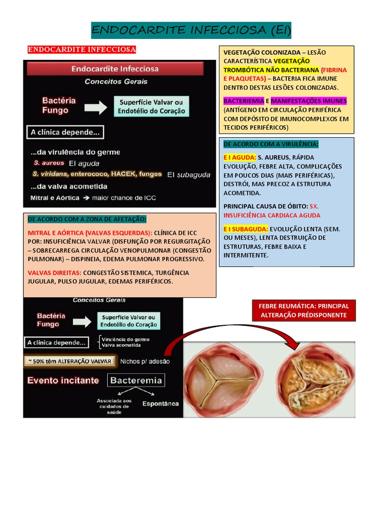 Endocardite Infecciosa | PDF | Sistema cardiovascular | Coração