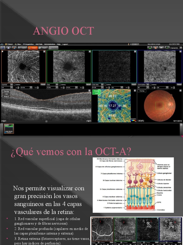 Angiografía OCT en Patologías Retinianas | PDF | Retina | Anatomía humana