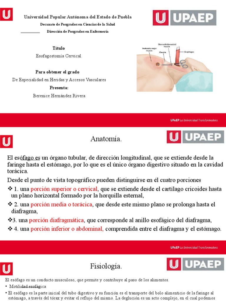 Presentacion de Esofagostomía | PDF | Estudios de idiomas extranjeros ...