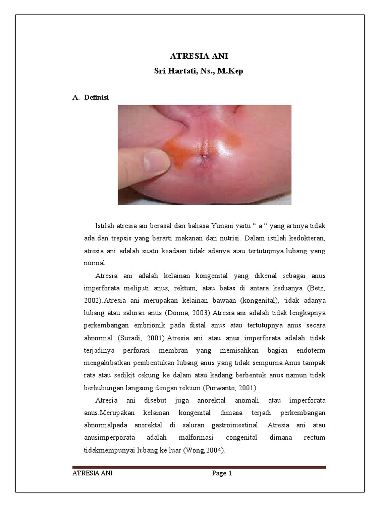 Atresia Ani | PDF