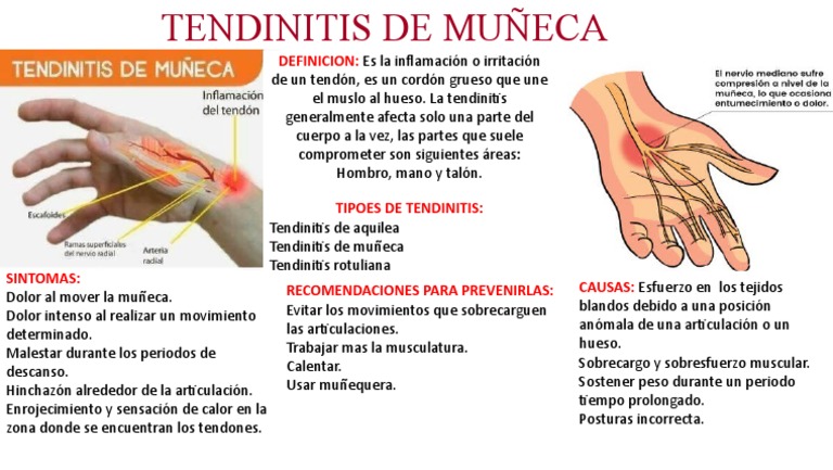 TENDINITIS DE MUÑECA | PDF