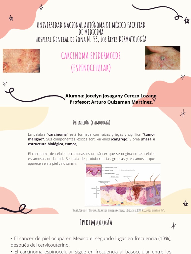 Carcinoma Epidermoide | PDF | Cáncer | Ciencias de la Salud