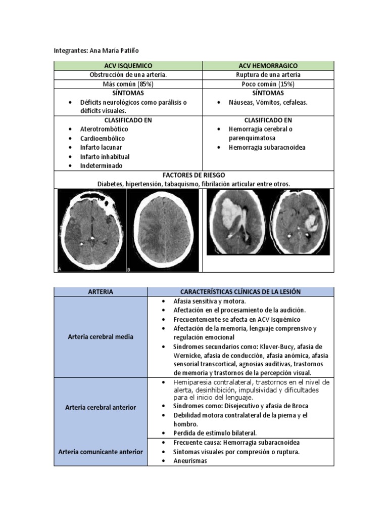 Acv Isquemico Acv Hemorragico | PDF | Carrera | Afasia