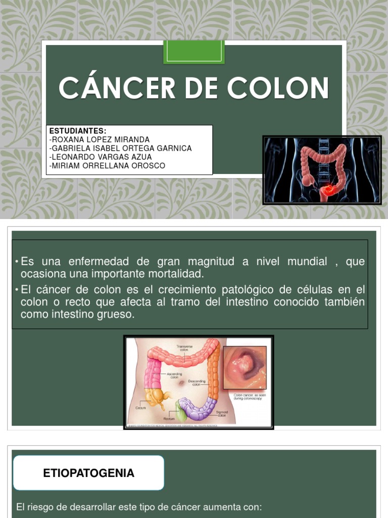 Diapositivas Cáncer de Colon | PDF | Cáncer colonrectal | Cáncer