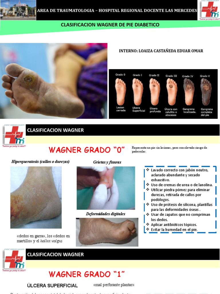 Clasificación Wagner del Pie Diabético | PDF | Medicina CLINICA ...
