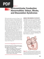 Delta Wave - LITFL Medical Blog - ECG Library Basics | PDF | Cardiac ...