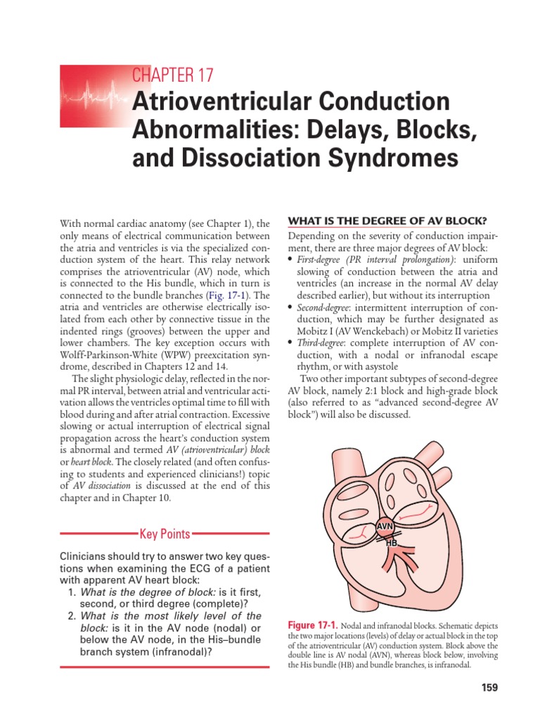 Atrioventricular Conduction Abnormalities | PDF | Electrocardiography ...