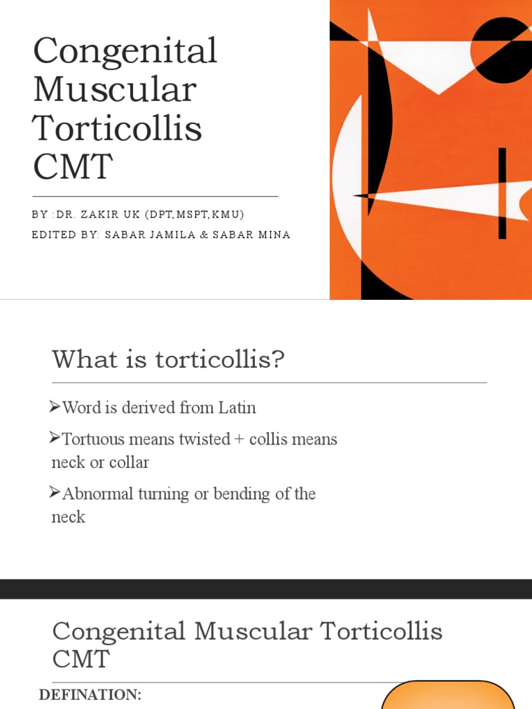 Congenital Muscular Torticollis Cmt By Dr Zakir Uk Dpt Mspt Kmu