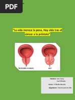 Triptico Cancer de Prostata | PDF | Cáncer | Cancer de prostata