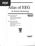 ACNS Standardized Critical Care EEG Examples 2021 | PDF ...