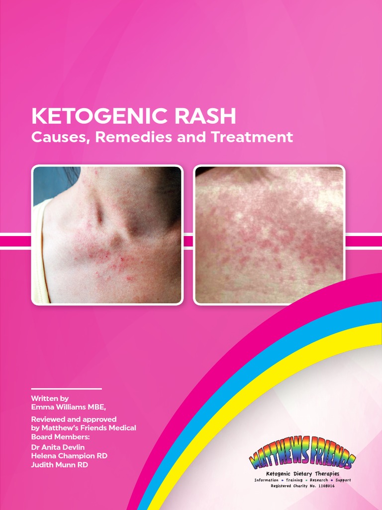 Ketogenic Rash: Causes, Remedies and Treatment | PDF | Ketogenic Diet ...
