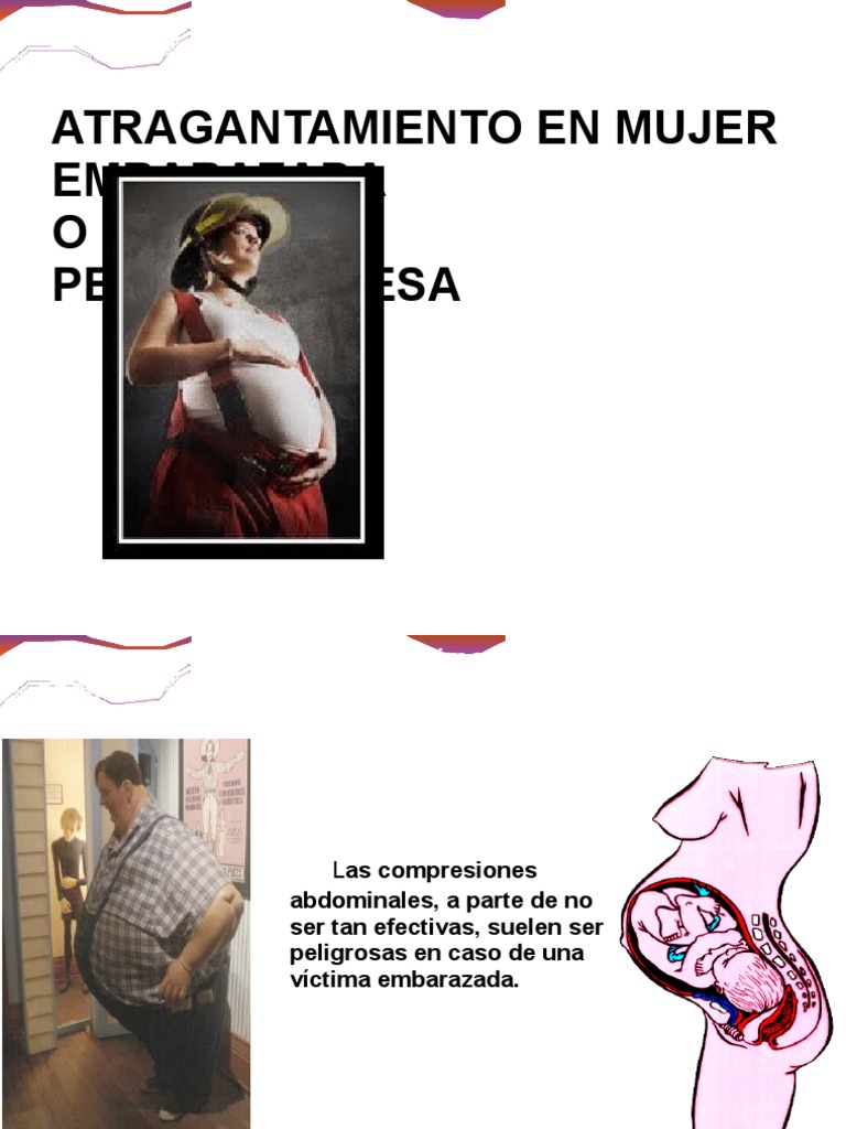 Atraganamiento en Mujer Embarazada o Persona Obesa | PDF