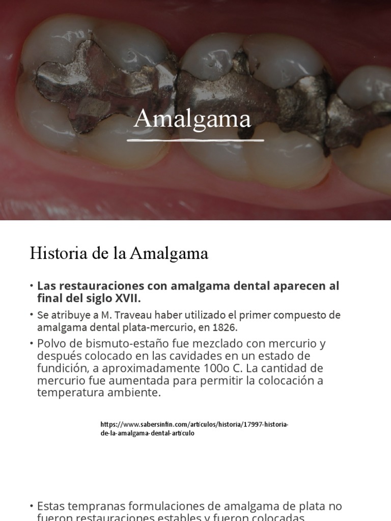 Amalgama Dental | PDF | Mercurio (Elemento) | Sustancias químicas