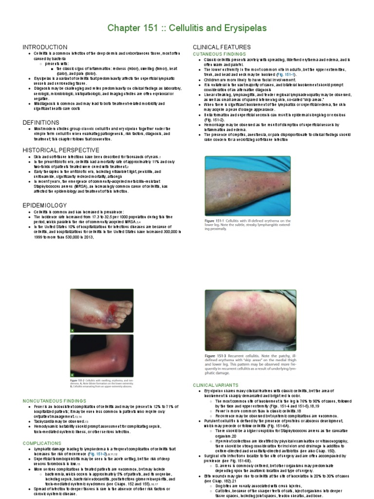 Chapter 151 - Cellulitis and Erysipelas | PDF | Methicillin Resistant ...