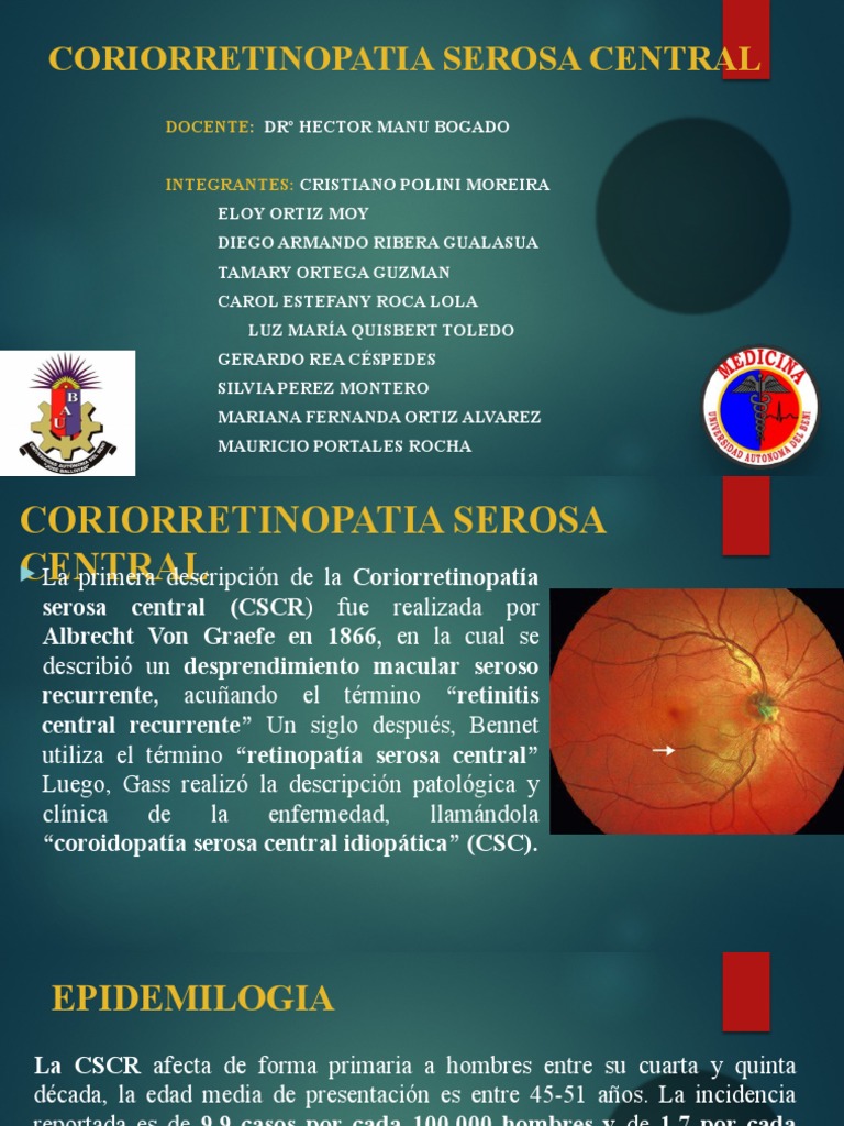 Un análisis de la coriorretinopatía serosa central: causas, síntomas ...