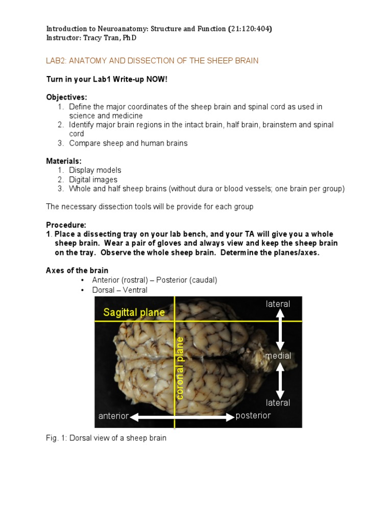 Lab2: Anatomy and Dissection of The Sheep Brain: Sagittal Plane | PDF ...