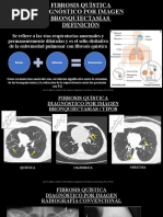 Anatomía de la Cápsula de Glisson | PDF | Tejido adiposo | Riñón