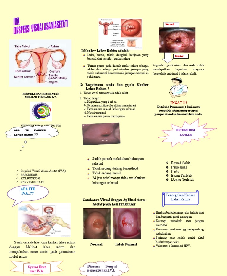 Leaflet Iva Test PKM G Tua | PDF