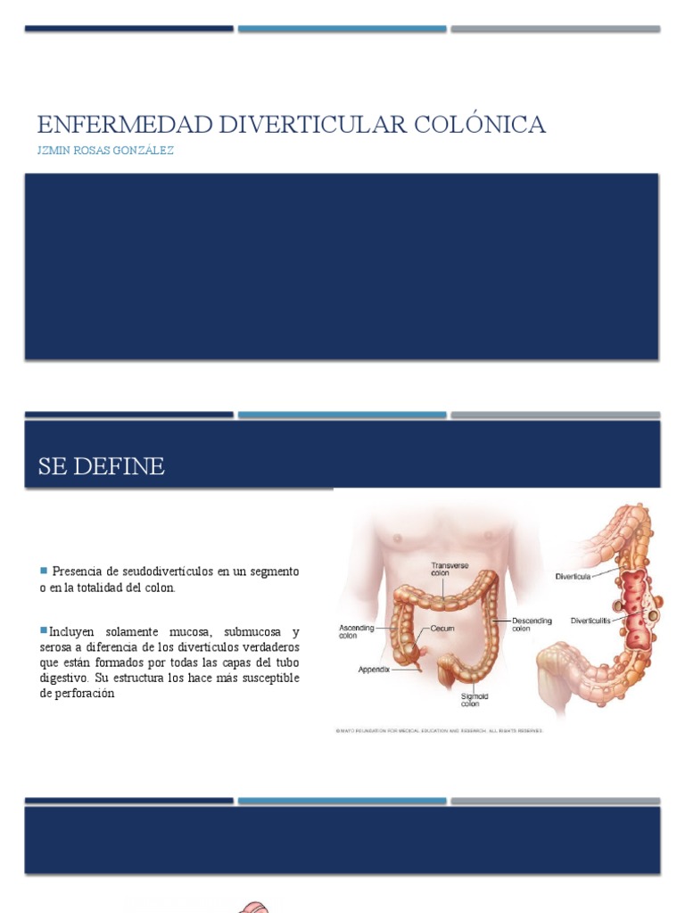 Enfermedad Diverticular Colónica | Descargar gratis PDF ...