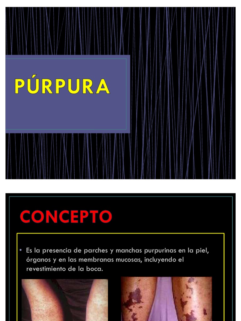 PÚRPURA | Plaqueta | Especialidades médicas