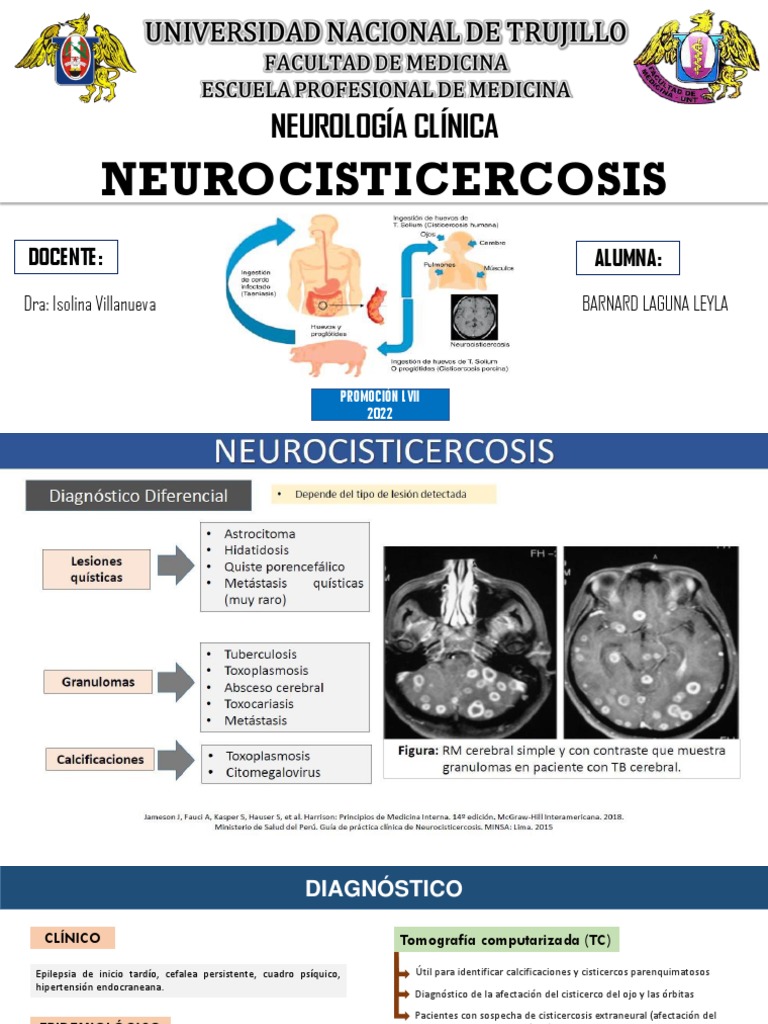 NEUROCISTICERCOSIS | PDF