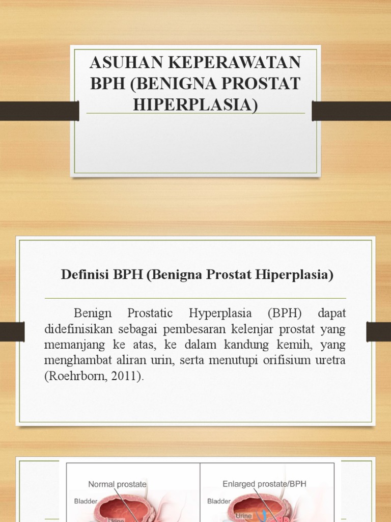 Asuhan Keperawatan BPH (Benigna Prostat Hiperplasia) | PDF