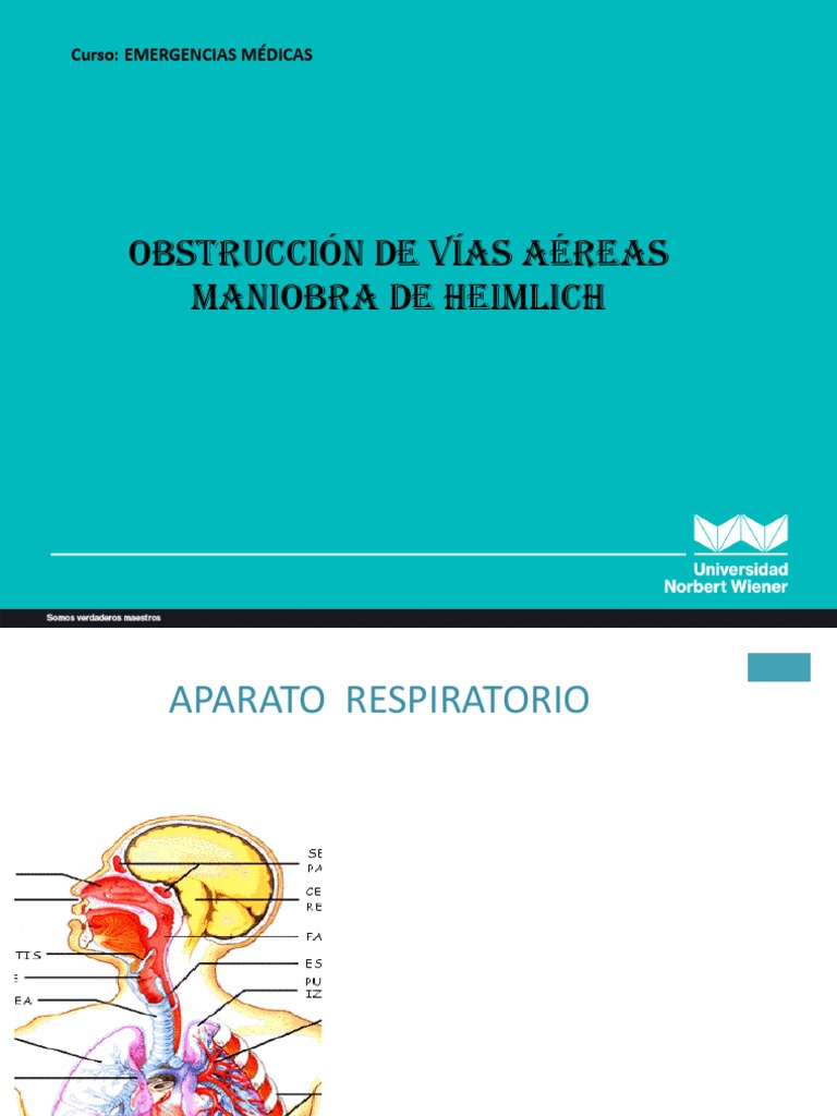 Clase 14 Obstrucción de Vías Aéreas Maniobra de Heimlich | Descargar ... Clase 14 Obstrucción de Vías Aéreas Maniobra de Heimlich | Descargar ...