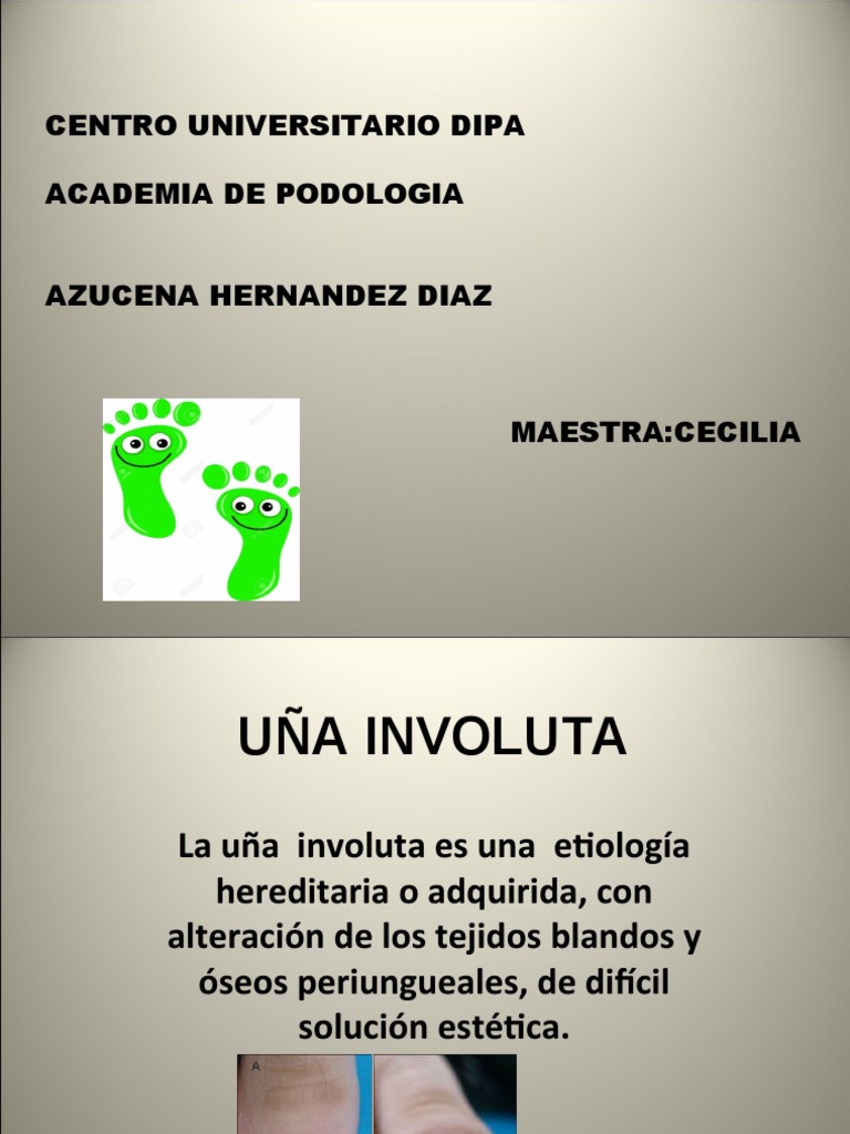 Tratamientos podológicos para diferentes patologías ungueales como la ...