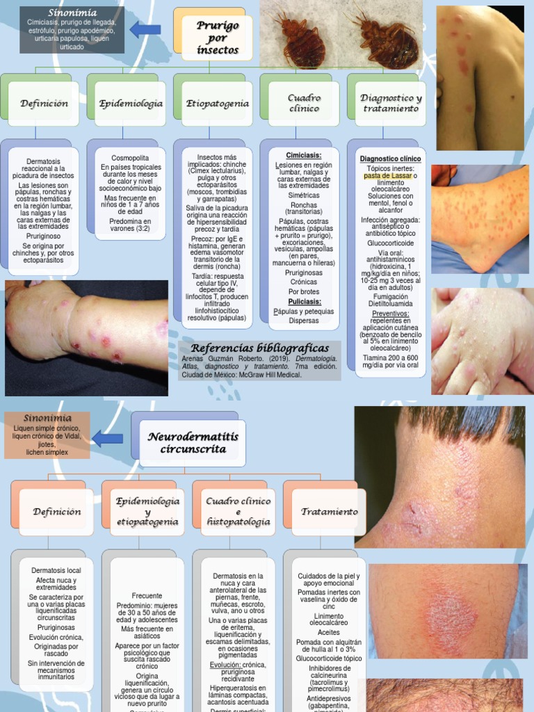 Prurigo Por Insectos y Neurodermatitis Circunscrita | PDF | Piel ...