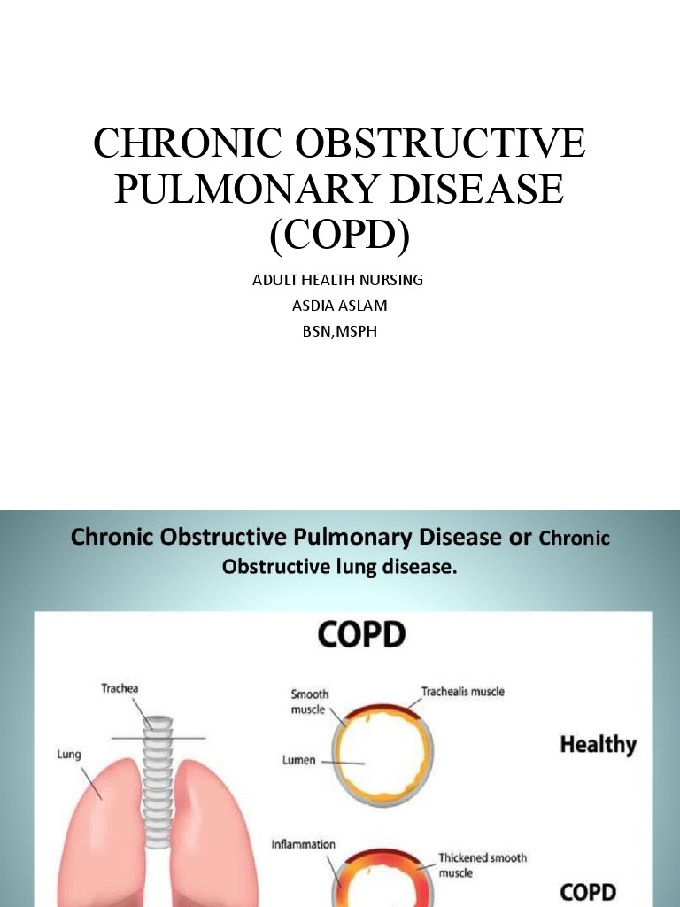 Chronic Obstructive Pulmonary Disorders Copd | PDF