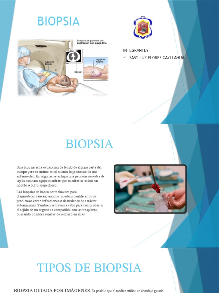 Tipos y Procedimientos de Biopsia | PDF | Biopsia | Cáncer