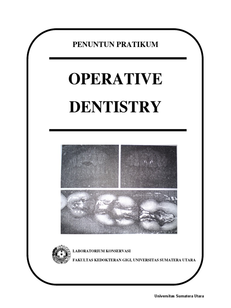 Operative Dentistry | PDF