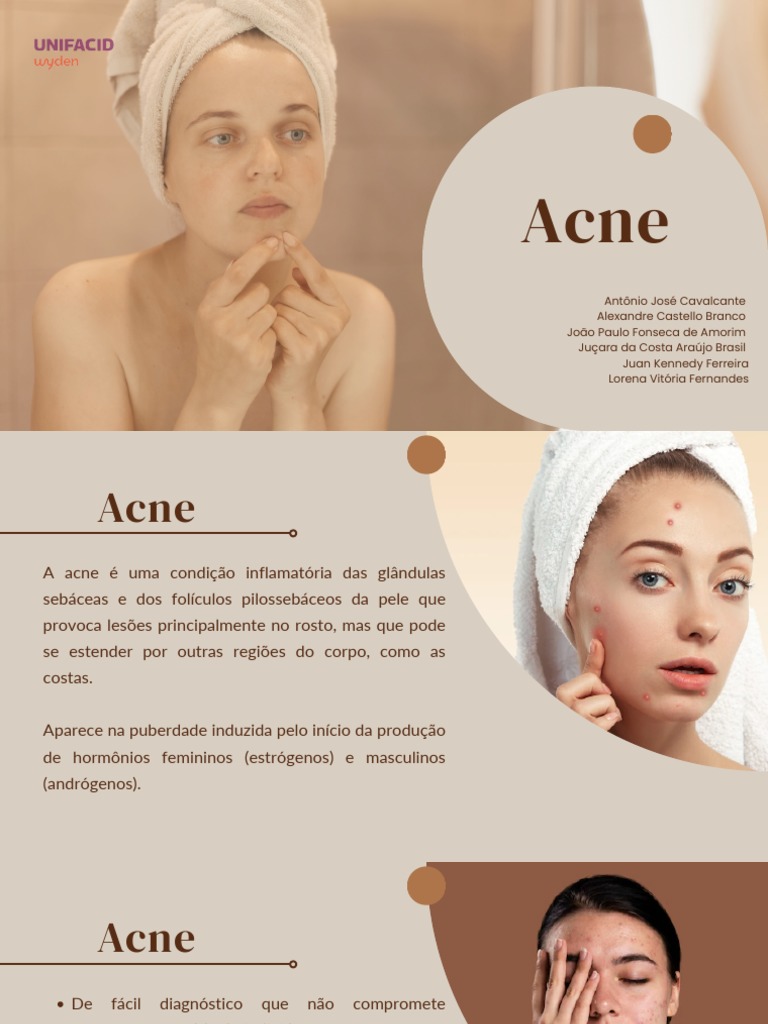 Acne Apresentação | PDF | Testosterona | Inflamação